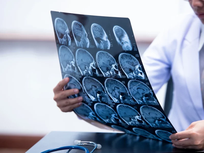 Traumatic Brain Injuries - Protection Law Group